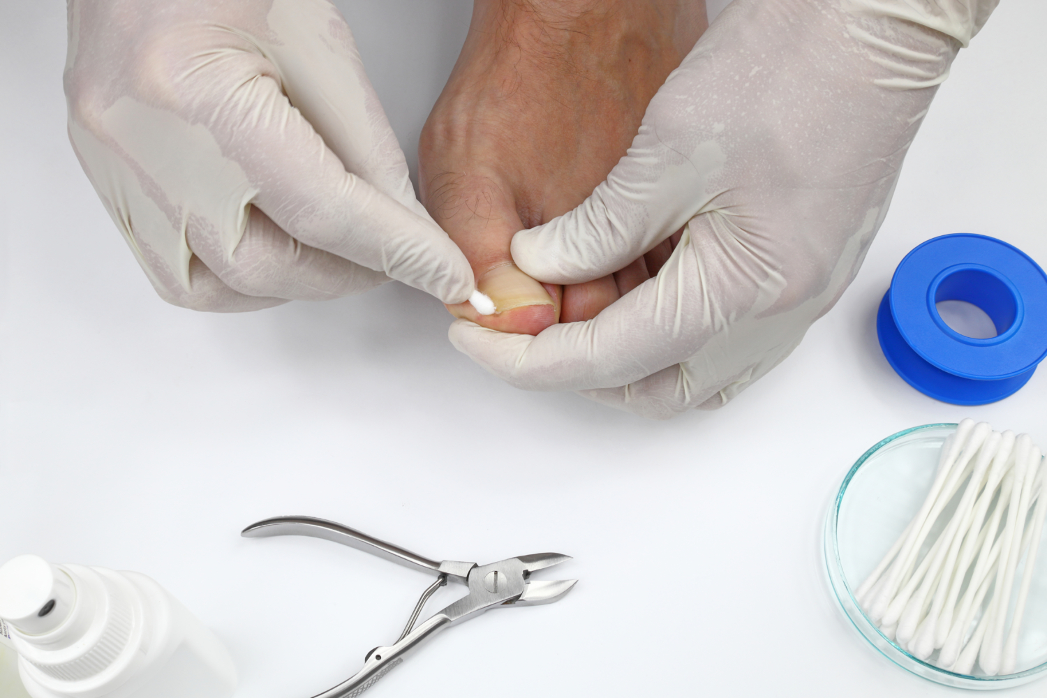 Services – FCHC Podiatry